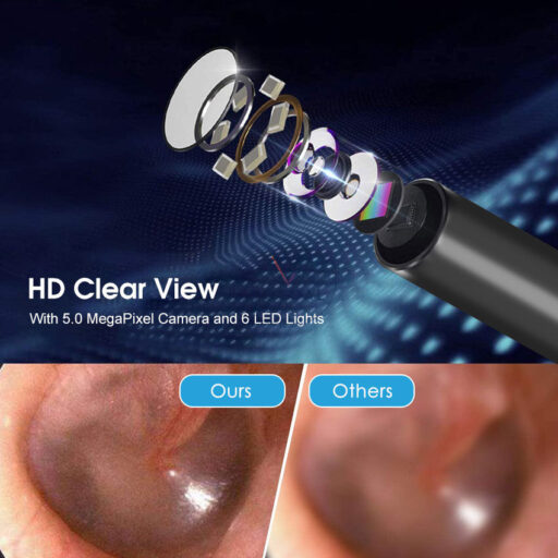 Vocoal Ear Pick Intelligent Visible Ear Spoon Ear Wax Removal Ear